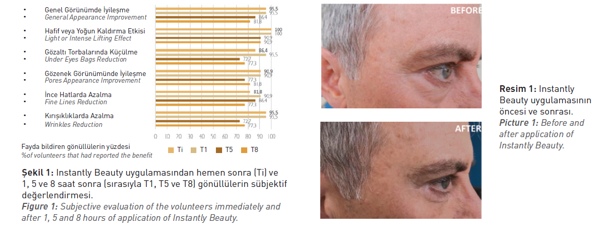Instant Botox Effect without the Need for Needles | Turkchem